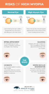 What Is High Myopia & Can It Cause Blindness? | Dr. Bishop & Associates